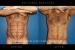 Pectoral Implants Gallery - Male Plastic Surgery Los Angeles